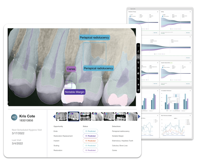Artificial Intelligence in Dentistry: Pearl’s Dental AI Solutions